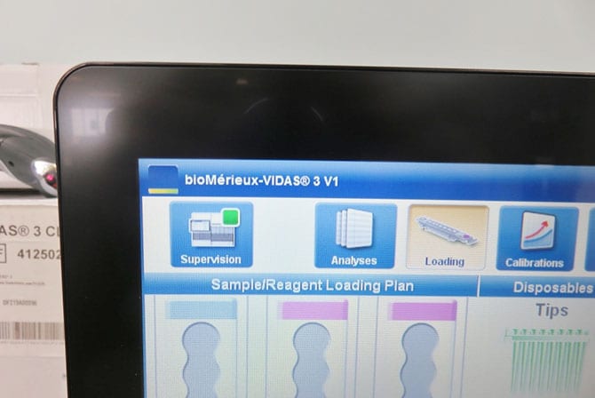 Biomerieux Vidas 3 Immunoanalyzer - The Lab World Group