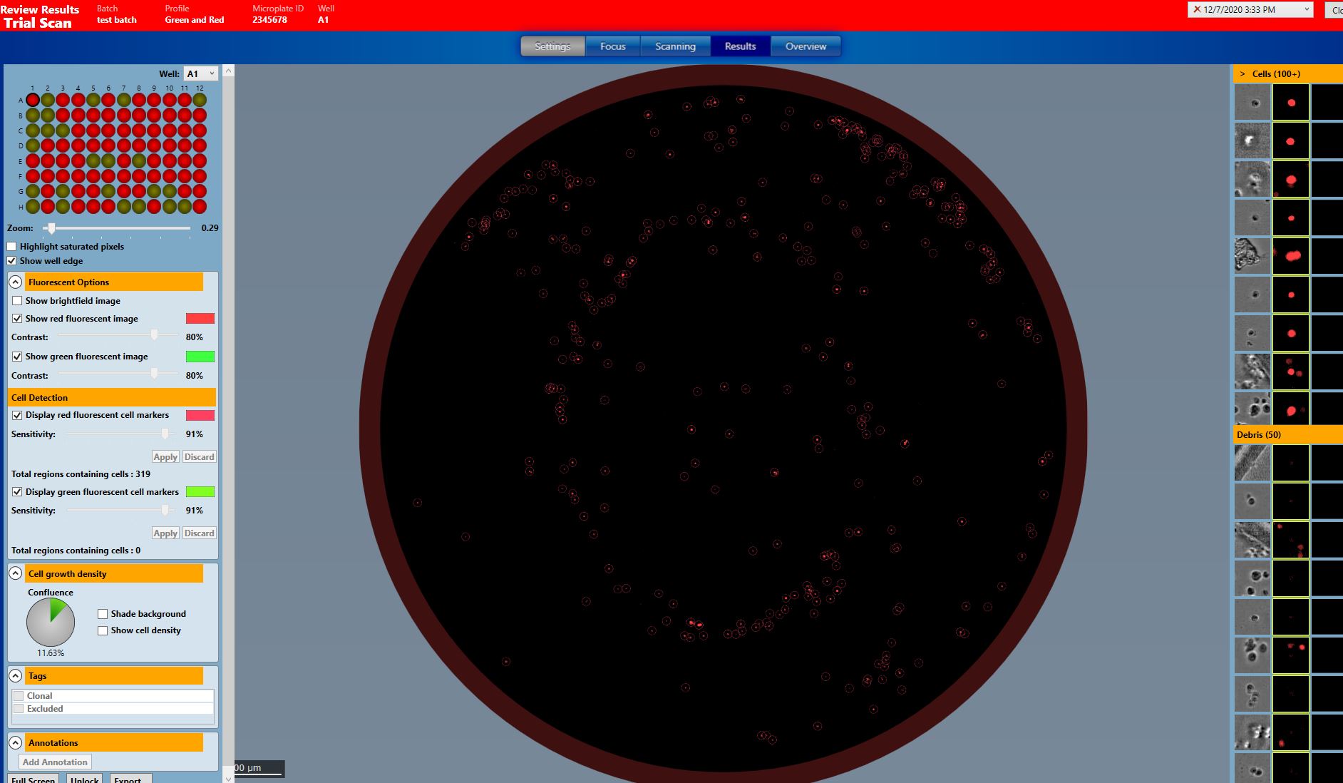 Solentim VIPS Single Cell Imager - The Lab World Group